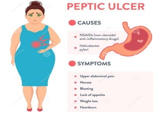 peptic ulcer disease.pptx