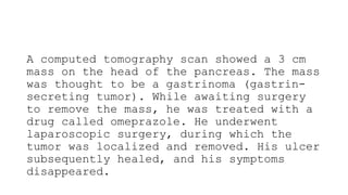Peptic Ulcer Disease.pptx f b bgdtsttffbssfg | PPTX