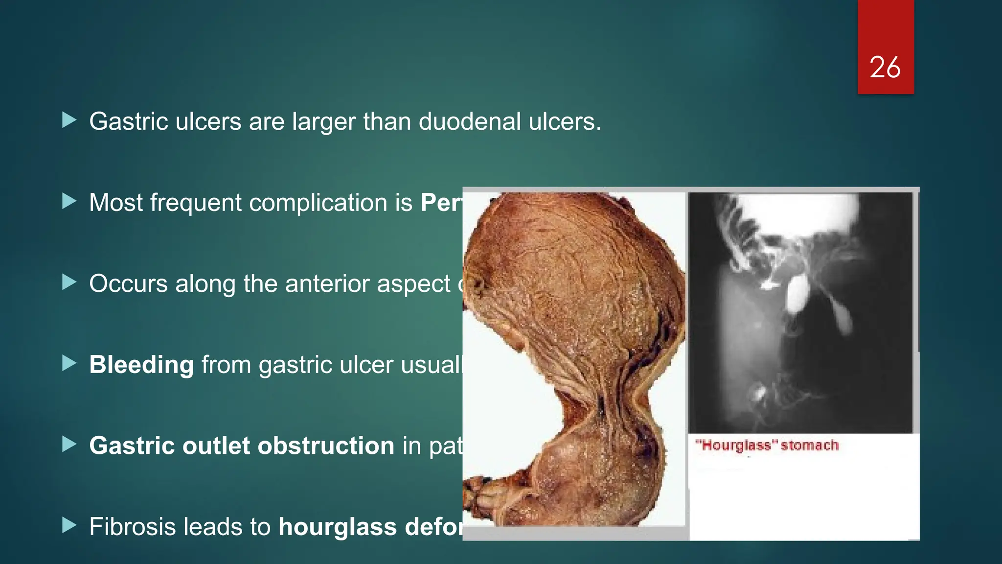 PEPTIC ULCER DISEASE medical management.pptx