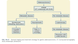 peptic ulcer disease clinicalfeatures.pptx