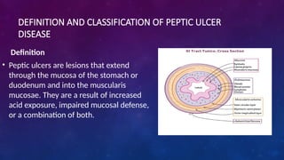 Brief presentation Peptic Ulcer Disease.pptx