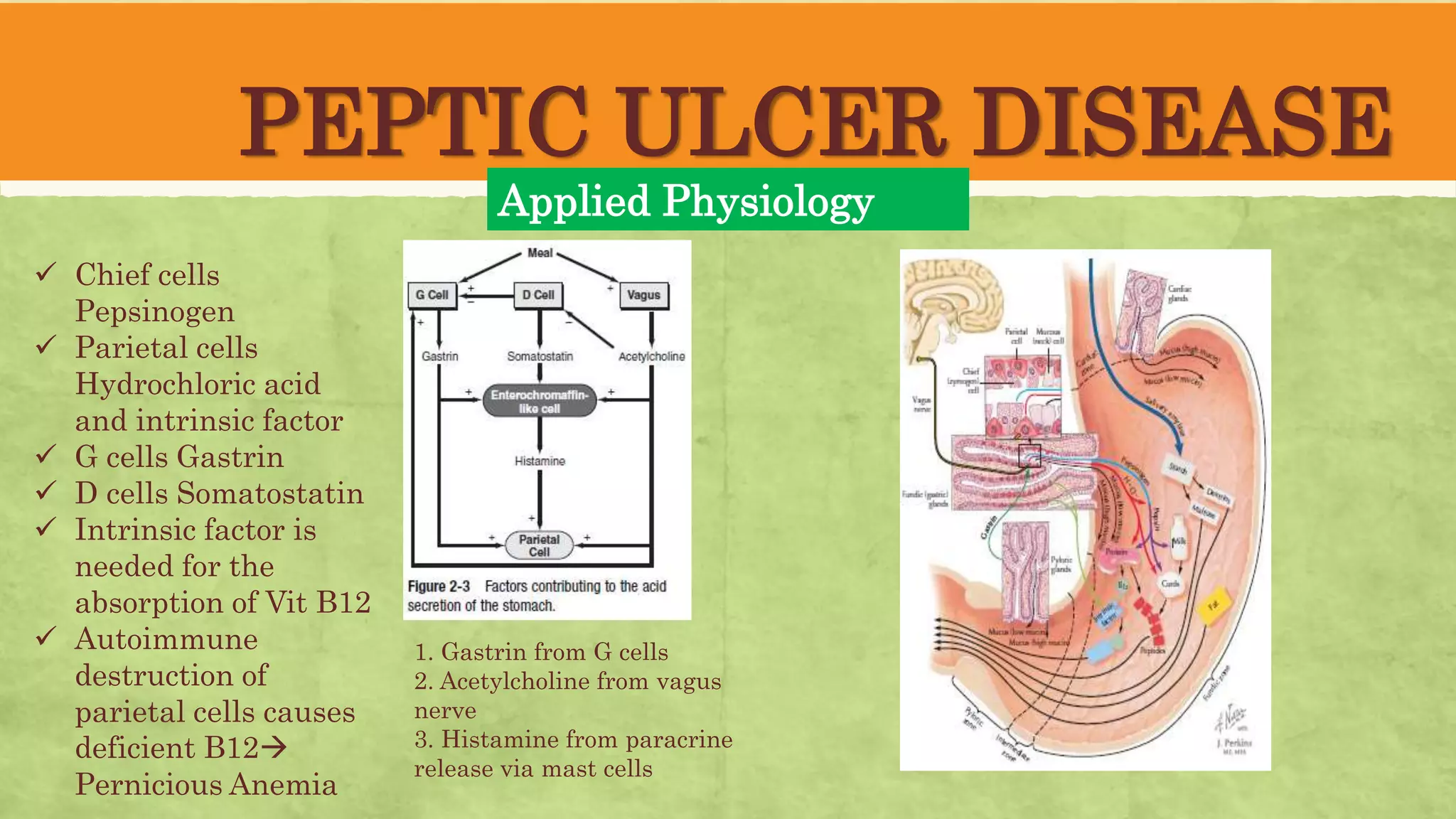 Peptic ulcer disease/ Epigastric pain | PPTX