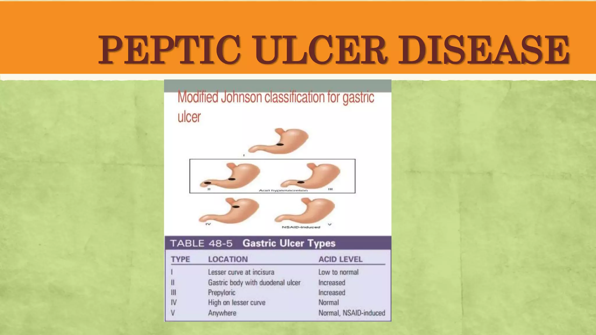 Peptic ulcer disease/ Epigastric pain | PPTX