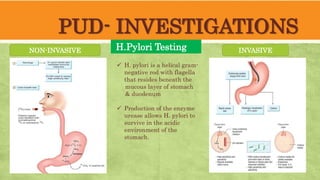 Peptic ulcer disease/ Epigastric pain | PPTX
