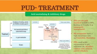 Peptic ulcer disease/ Epigastric pain | PPTX