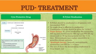 Peptic ulcer disease/ Epigastric pain | PPTX