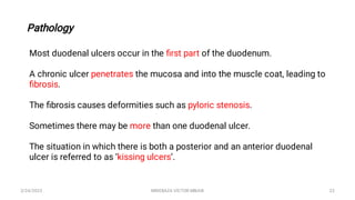 Peptic Ulcer Disease- MWEBAZA VICTOR pdf | PDF
