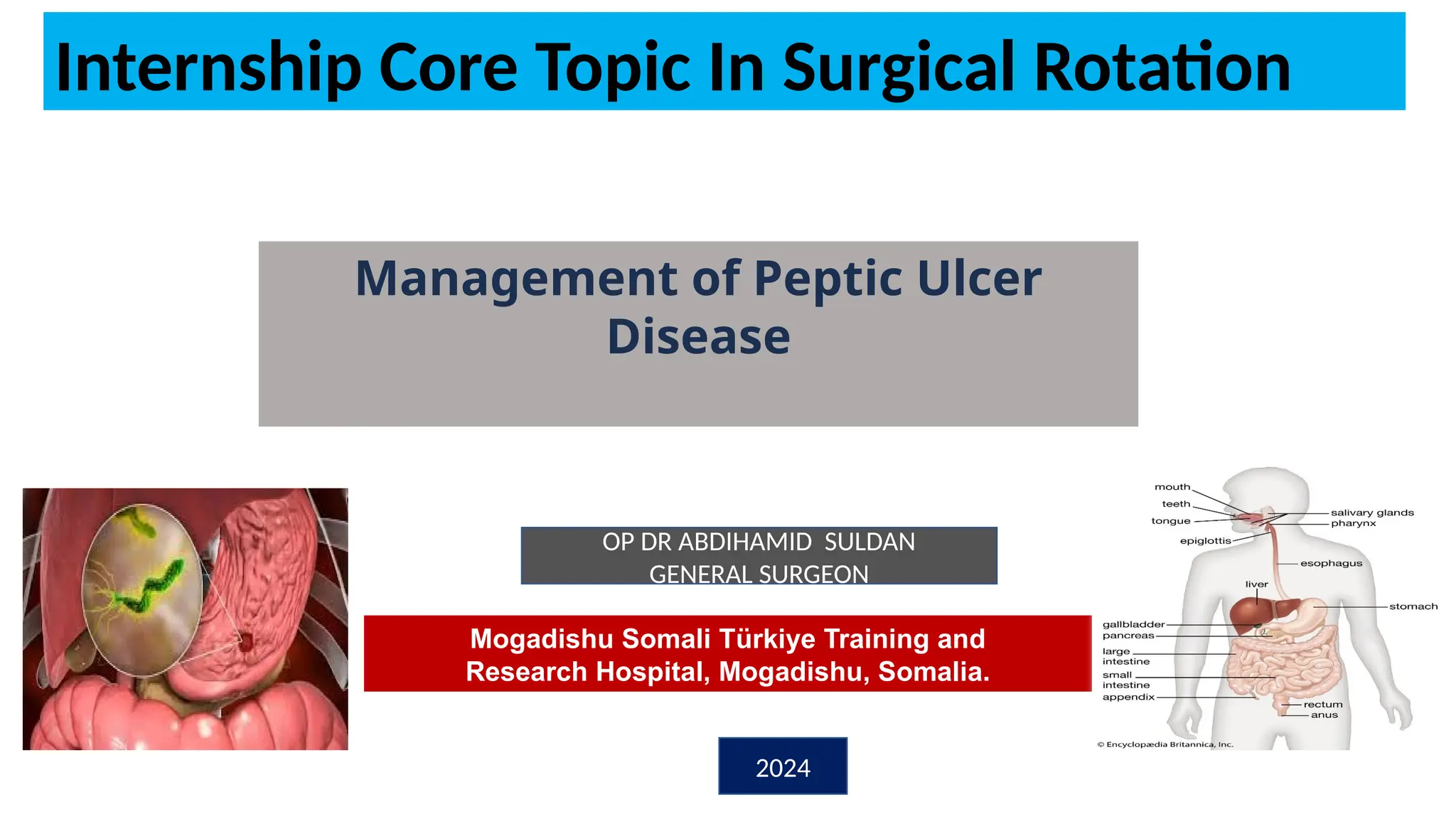 Peptic ulcer disease Very important topic for undergraduate I peptic ...