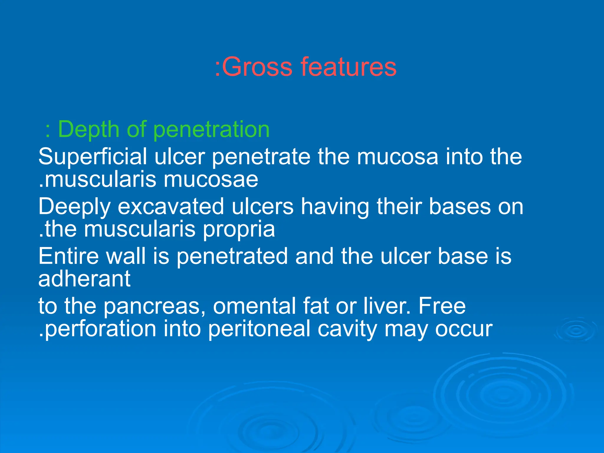 peptic ulcer disease 2.pptx.............. | PPTX
