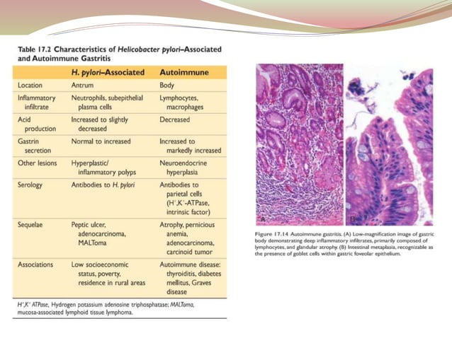Peptic Ulcer Disease DG.pptx