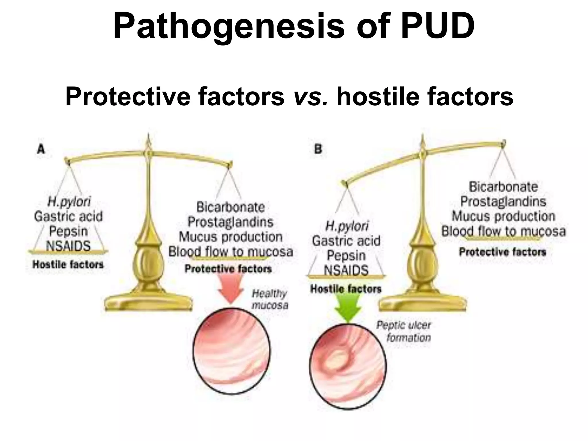 Peptic Ulcer Disease, GORD, Nausea & Vomiting. Constipation & Diarrhea ...