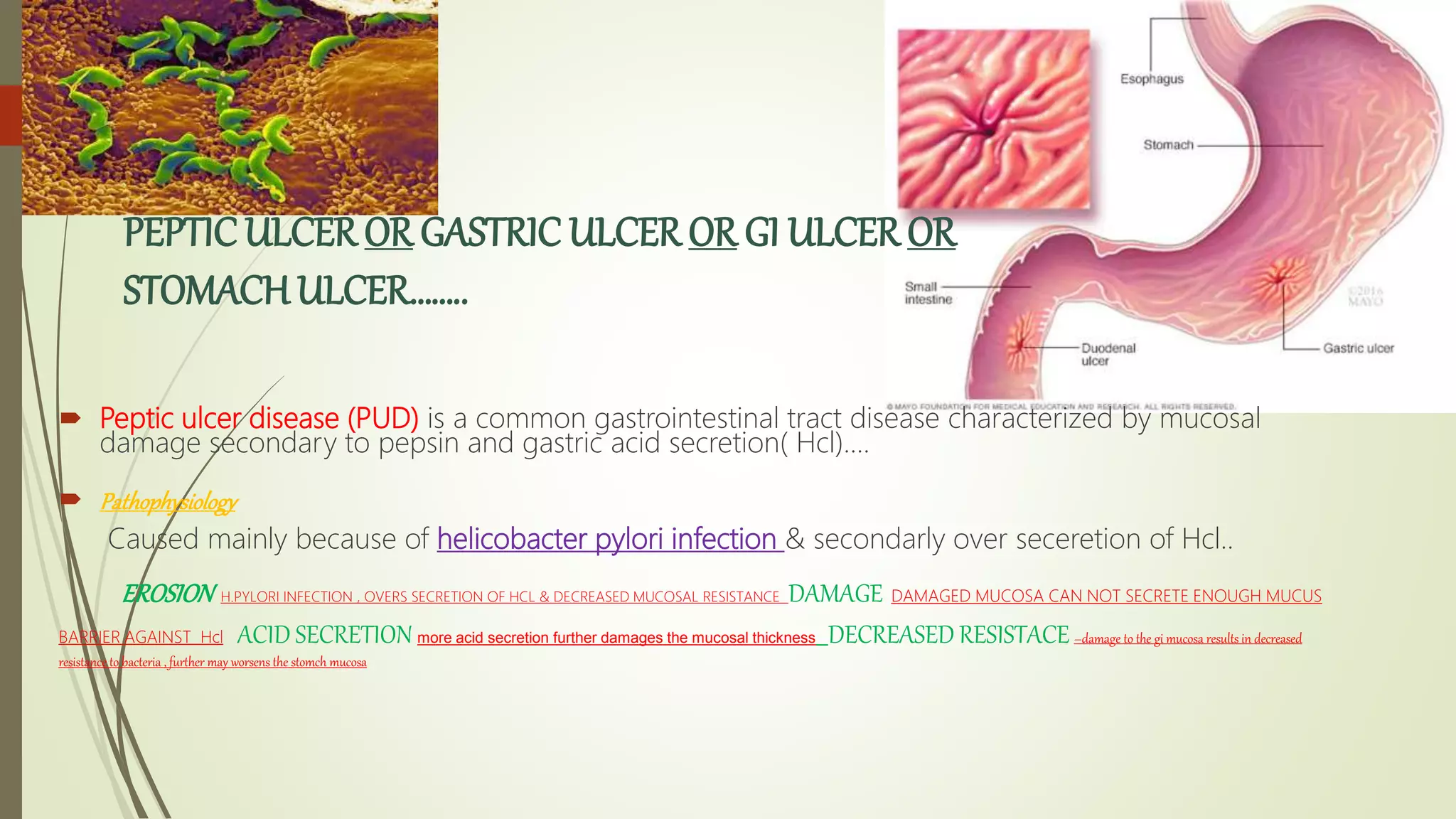 PEPTIC ULCER DISEASE MANAGEMENT MURUGESH.pptx