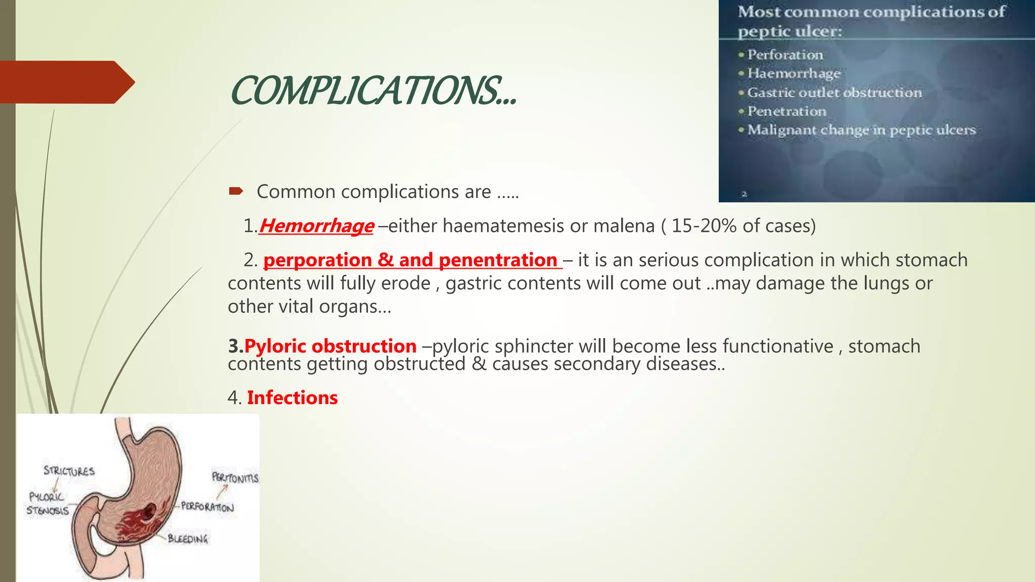 PEPTIC ULCER DISEASE MANAGEMENT MURUGESH.pptx