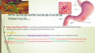 PEPTIC ULCER DISEASE MANAGEMENT MURUGESH (1).pptx