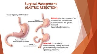 PEPTIC ULCER DISEASE PRESENTATION by MLSC.pptx