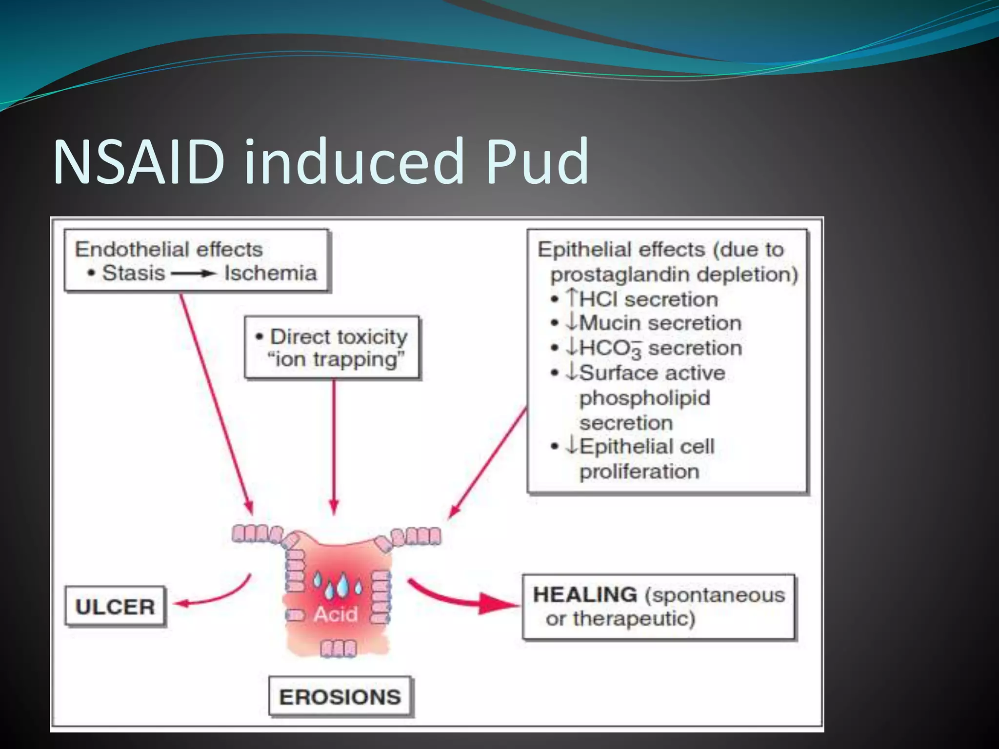 Peptic ulcer disease(PUD) | PPTX