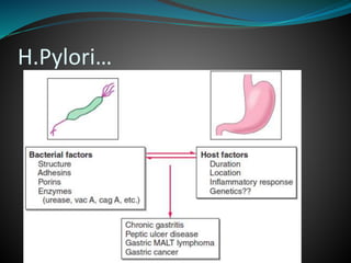 Peptic ulcer disease(PUD) | PPTX