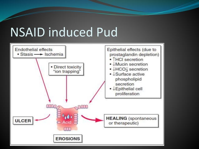 Peptic ulcer disease(PUD) | PPTX