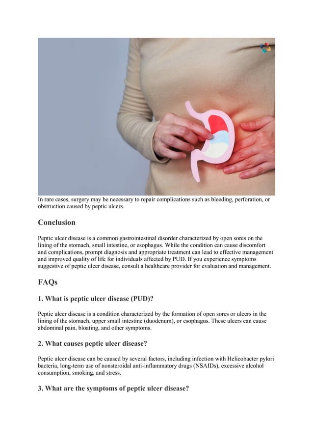 Peptic Ulcer Disease: Understanding Causes, Symptoms, and Treatment ...