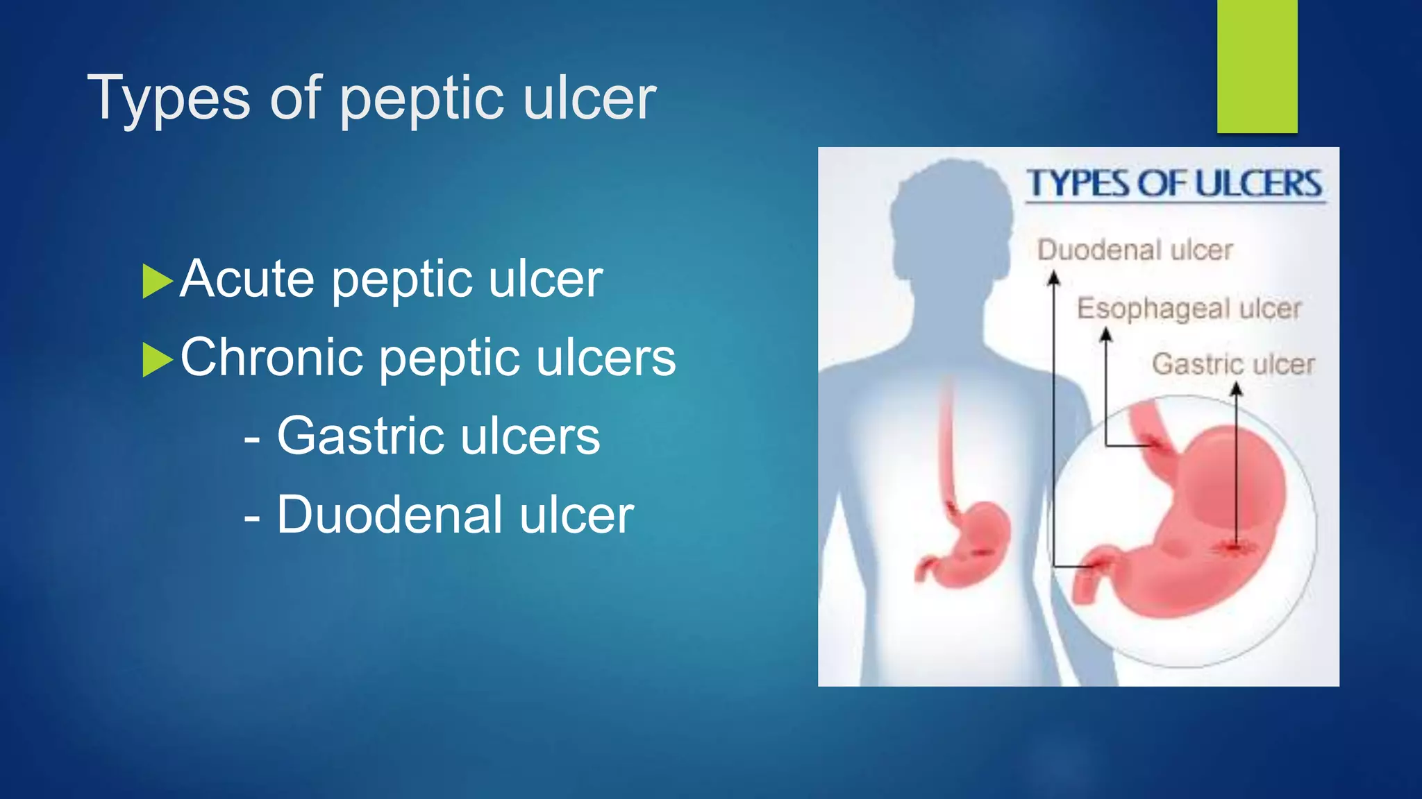 Peptic ulcer drugs | PPTX