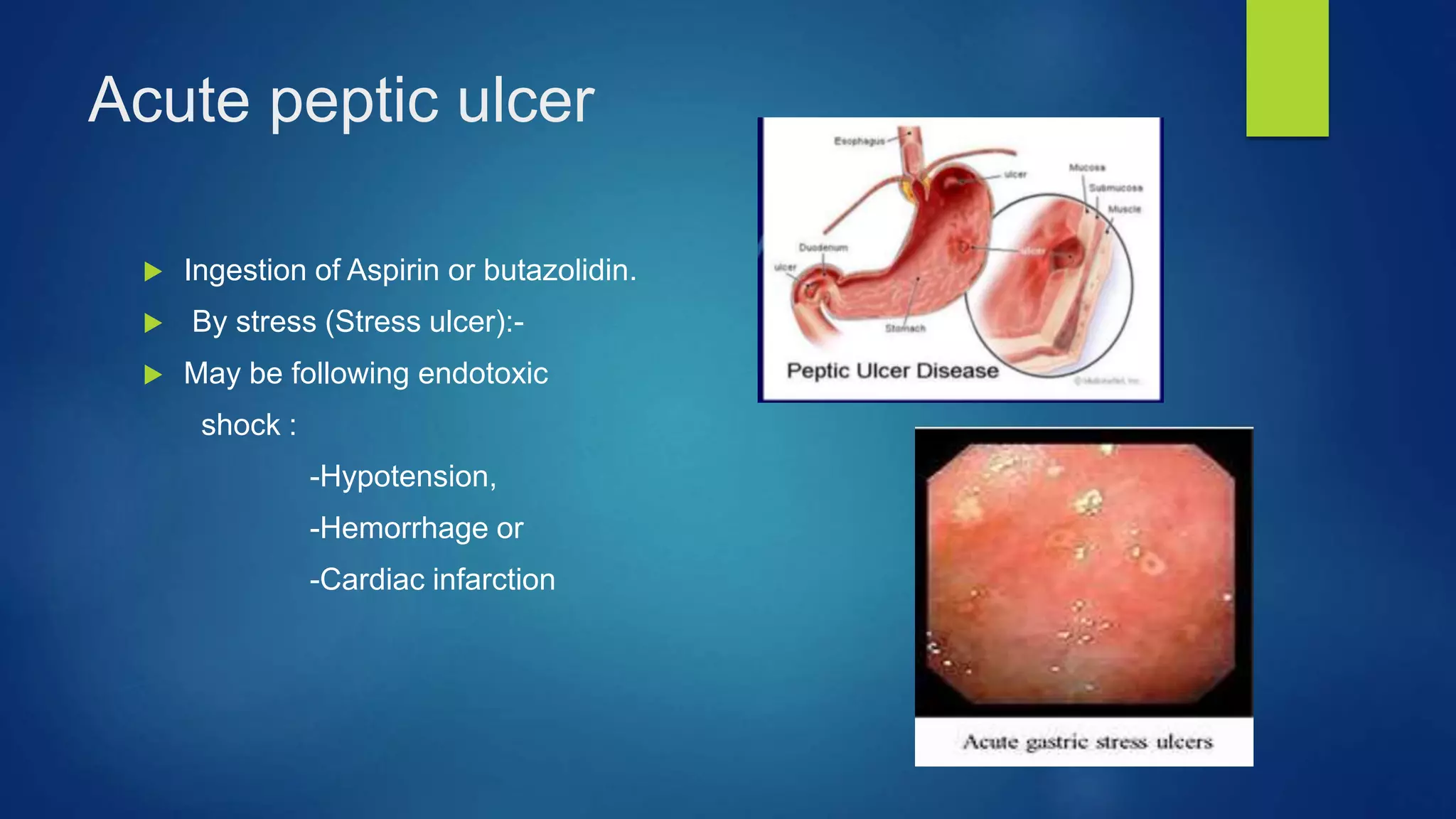 Peptic ulcer drugs | PPTX