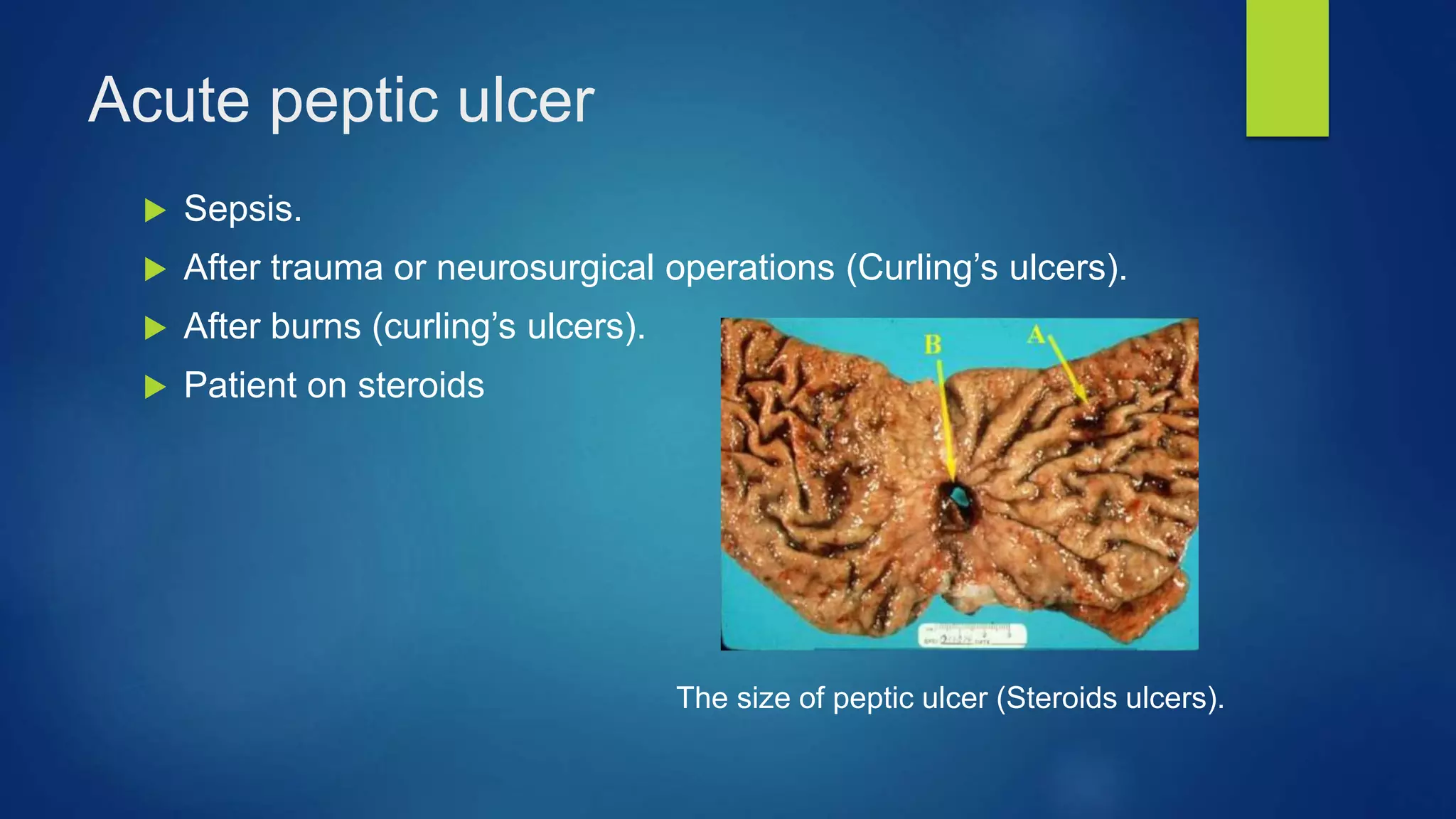 Peptic ulcer drugs | PPTX