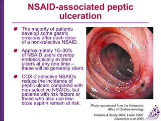 Peptic ulcer management in the era of nsaid | PPT