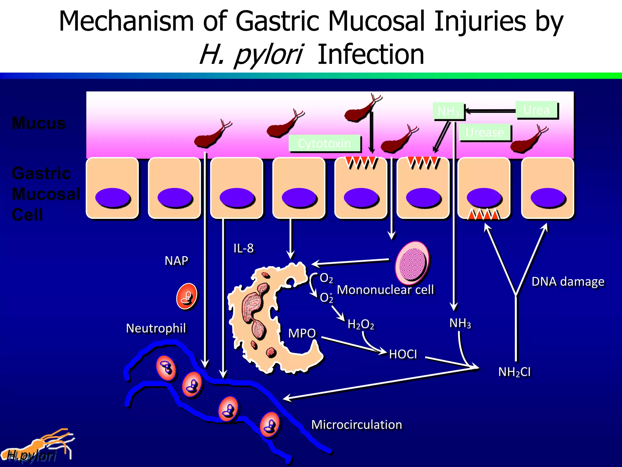 Peptic ulcer disease | PPTX