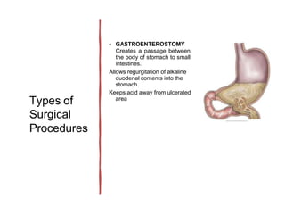 peptic ulcer mohammad abu sad 1.pptx