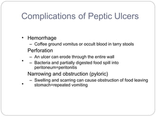 Peptic ulcer | PPT