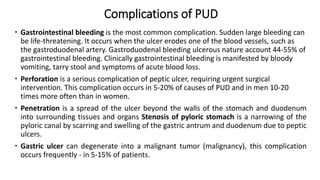 Peptic ulcer of stomach and duodenum | PPTX