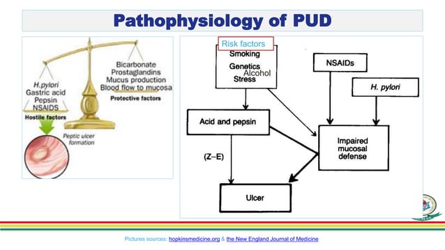 Peptic ulcer pathophysiology | PPTX