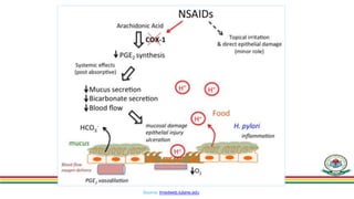 Peptic ulcer pathophysiology | PPTX