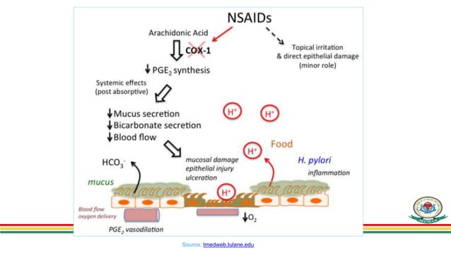 Peptic ulcer pathophysiology | PPTX