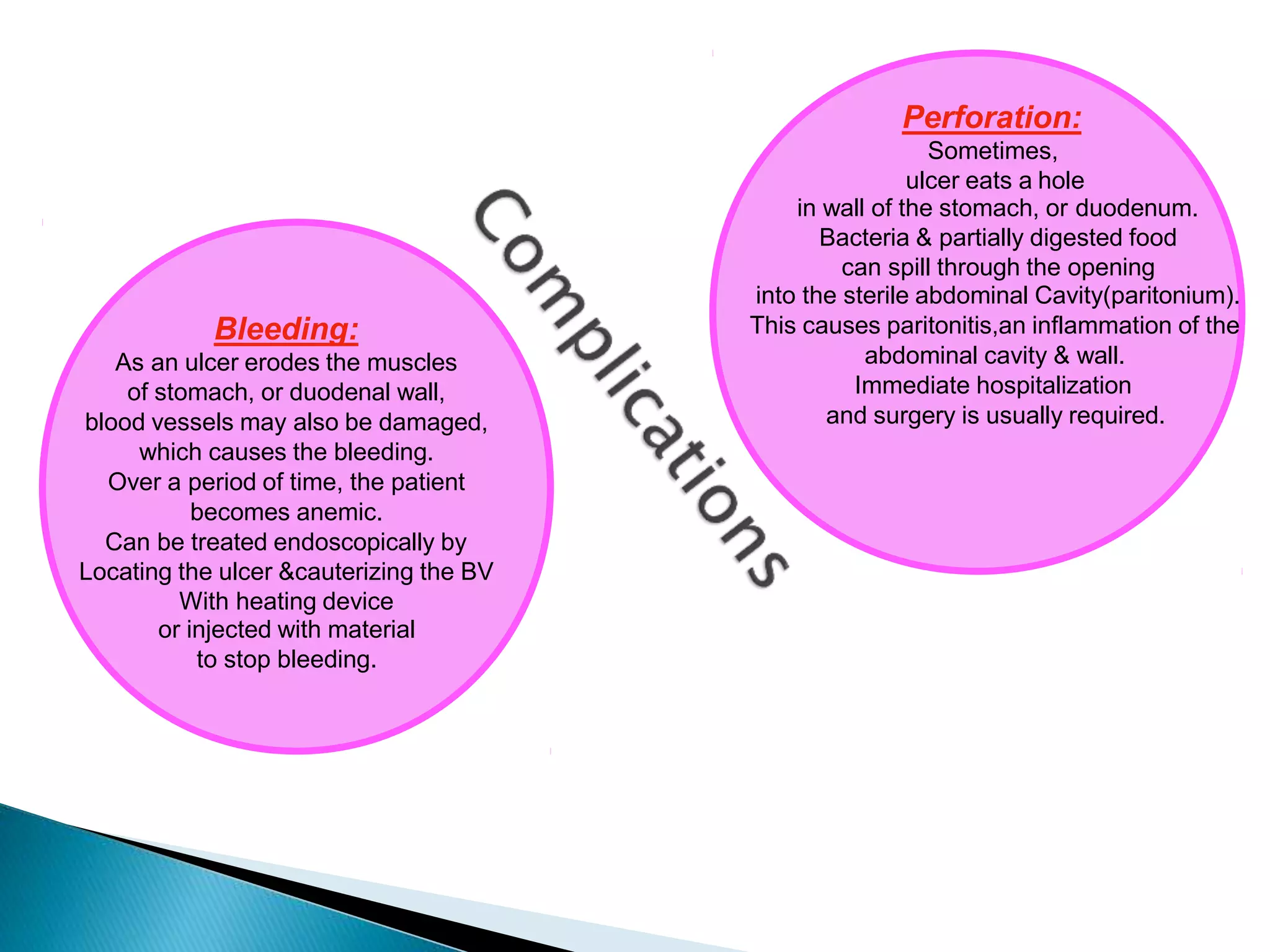 Peptic ulcer ppt | PPTX