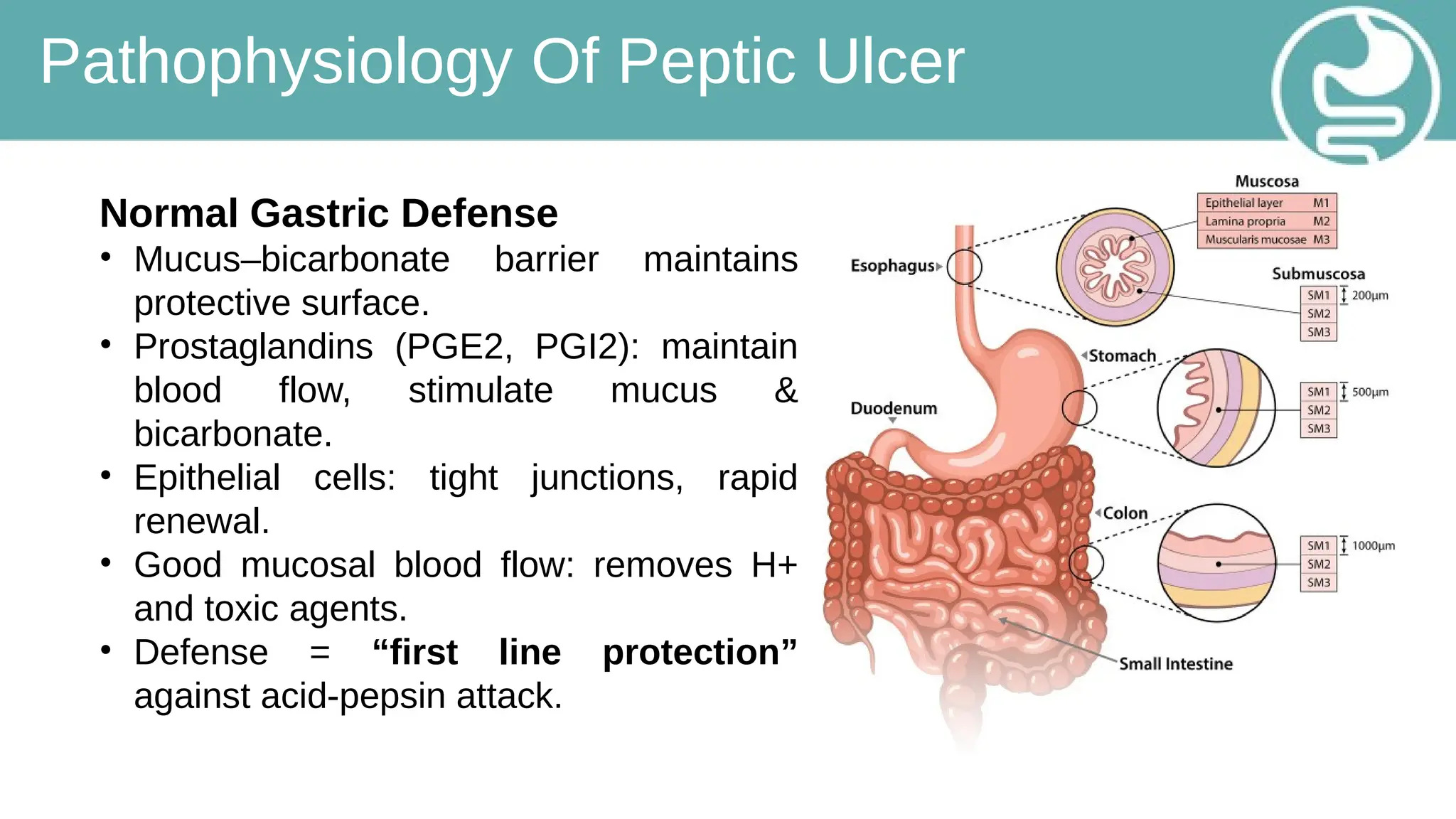 Peptic ulcer presentation by UOS Students | PPTX
