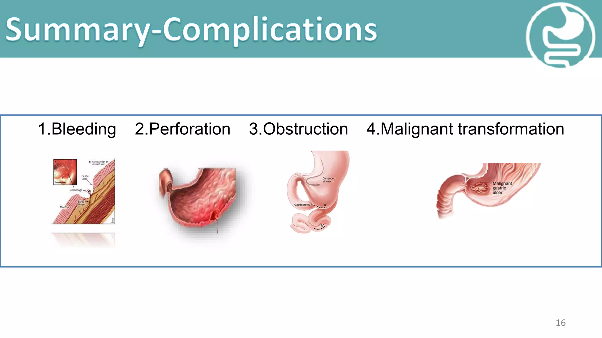 Peptic ulcer rayan saleh al humaid - 1 | PDF