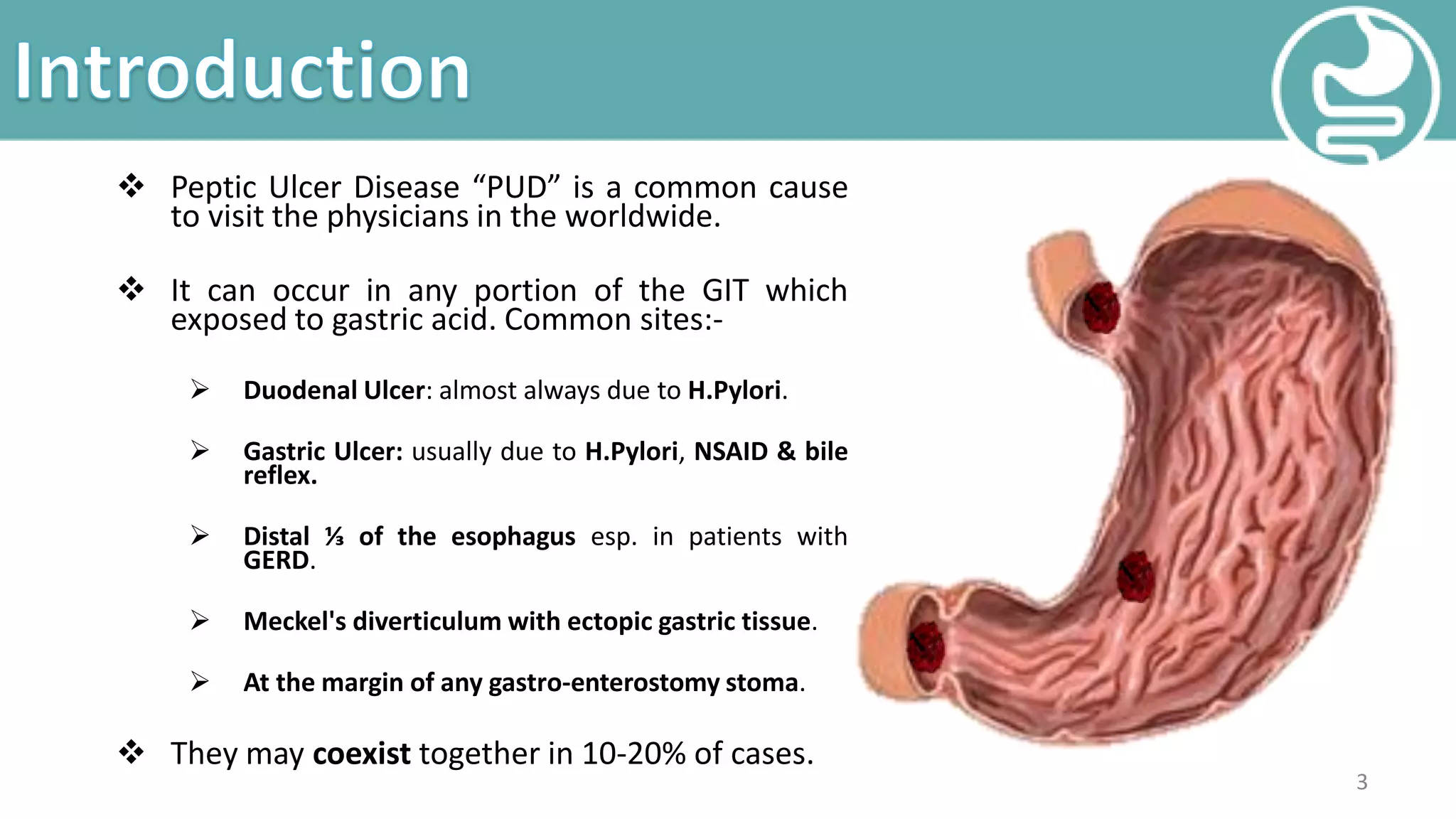 Peptic ulcer rayan saleh al humaid - 1 | PDF