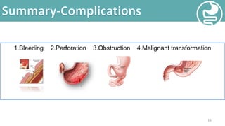 Peptic ulcer rayan saleh al humaid - 1 | PPT