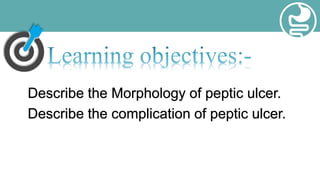 Peptic ulcer rayan saleh al humaid - 1 | PPT