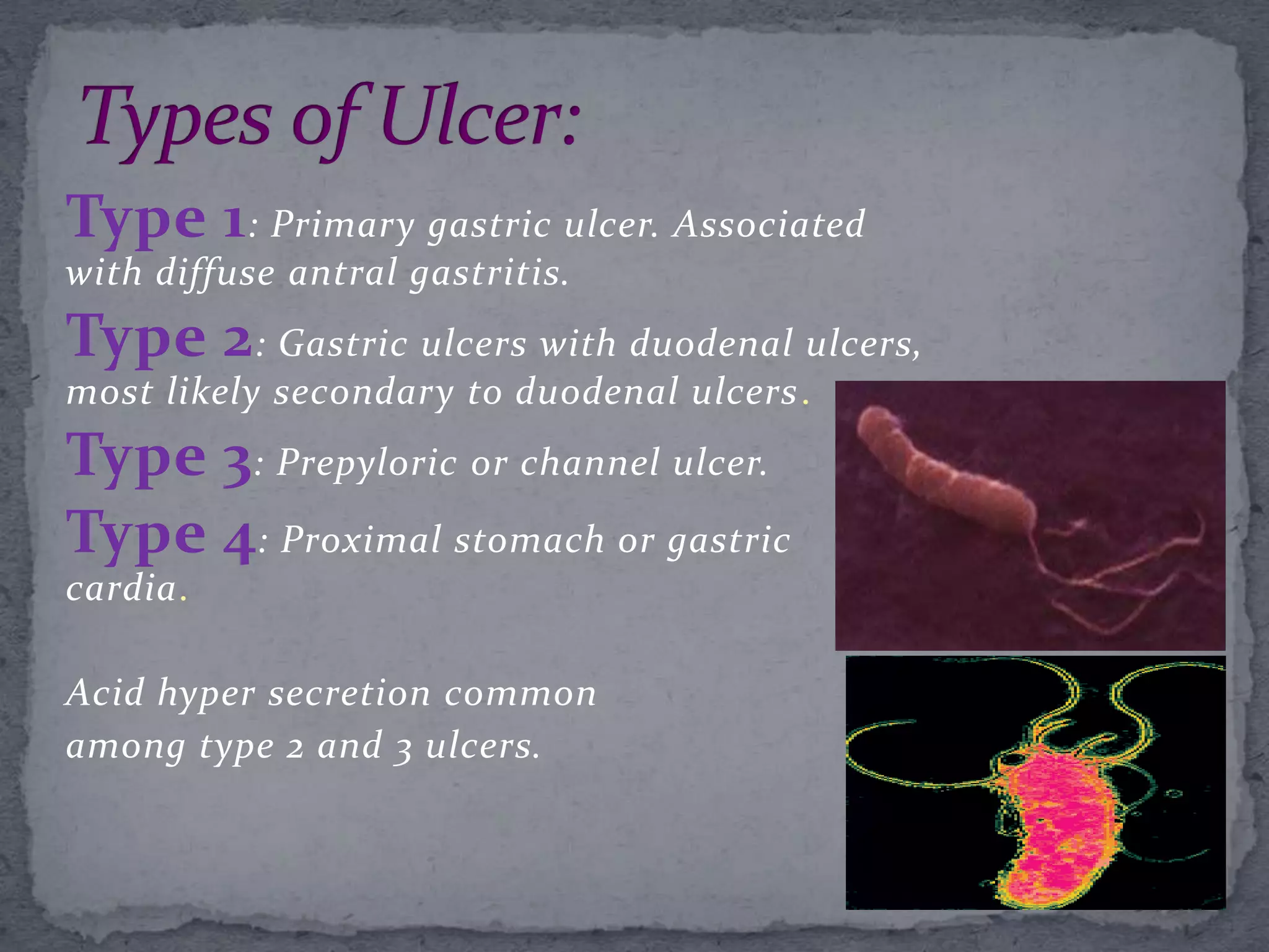 Peptic ulcers | PPTX