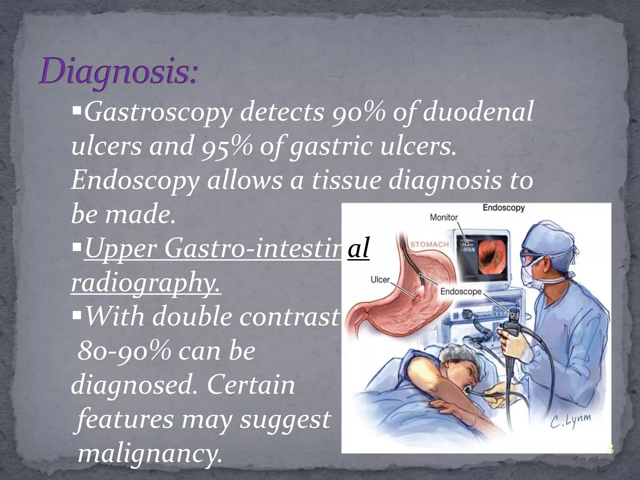 Peptic ulcers | PPTX