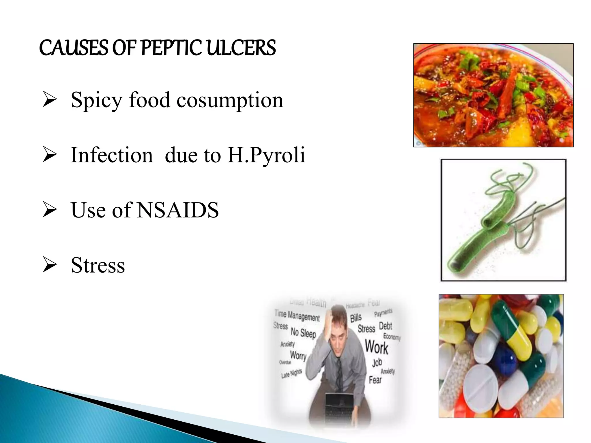 Peptic Ulcers Pathophysiology | PPT
