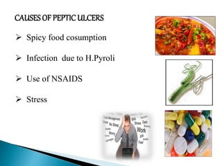 Peptic Ulcers Pathophysiology | PPT