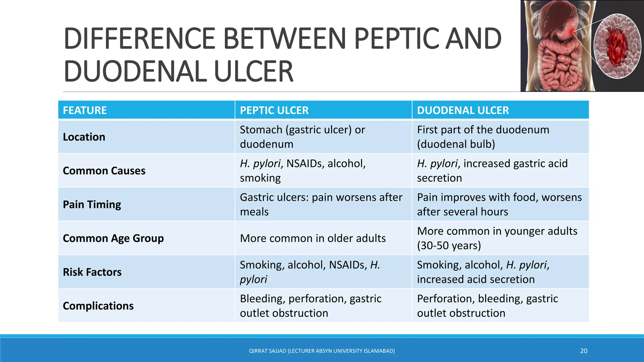 PEPTIC ULCERS (1).pdf PEPTIC ULCERS (1).pdfPEPTIC ULCERS (1).pdf