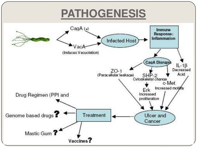 Peptic Ulcer Disease Education