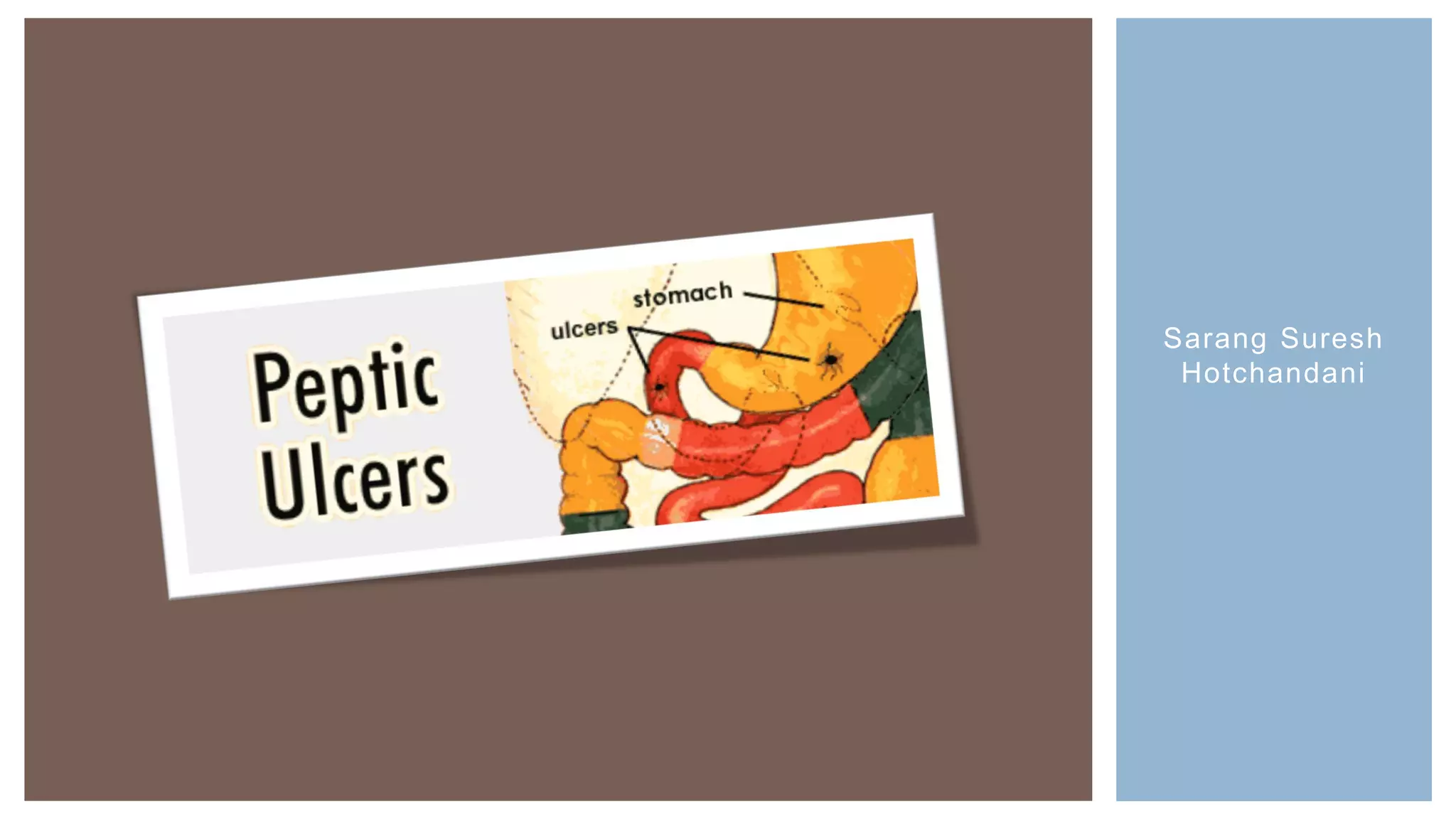 Peptic Ulcer | PPT