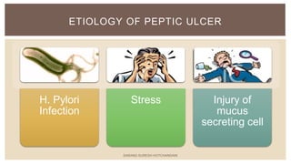 Peptic Ulcer | PPT