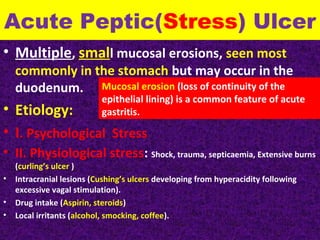 Peptic ulcer st f n | PPT