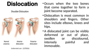 PHYSICAL EDUCATION 9- Q1-THE BASICS OF FIRST AID.pptx
